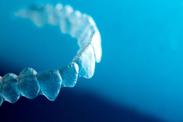 Know Your Invisalign Timeline - Clearwater, FL Dentist